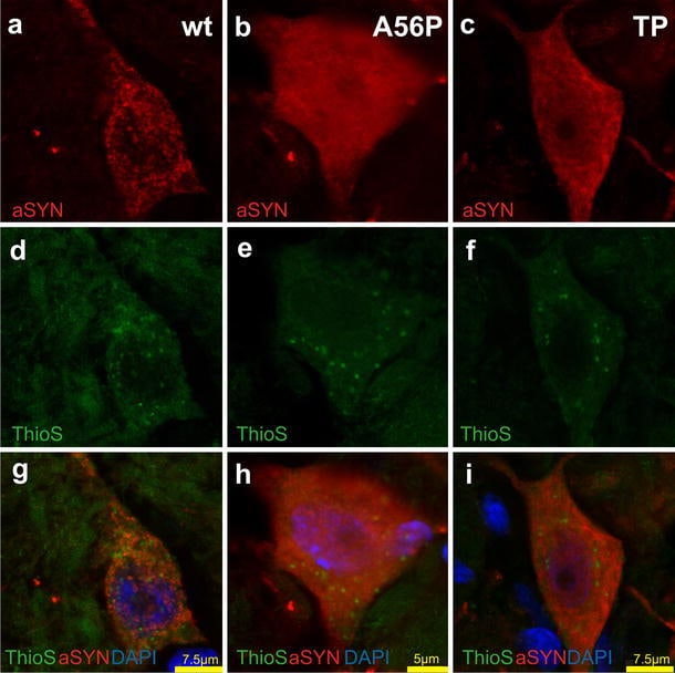 alpha Synuclein Antibody (Monoclonal, Syn 211)