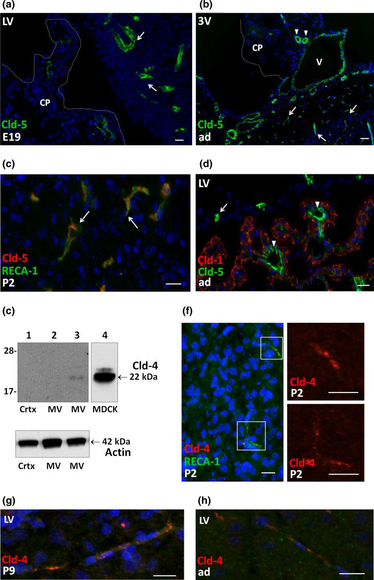 Claudin 5 Antibody (Monoclonal, 4C3C2)