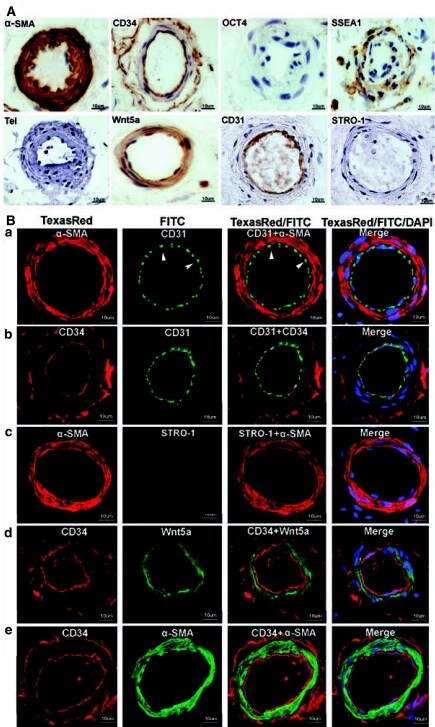 STRO-1 Antibody (39-8401)