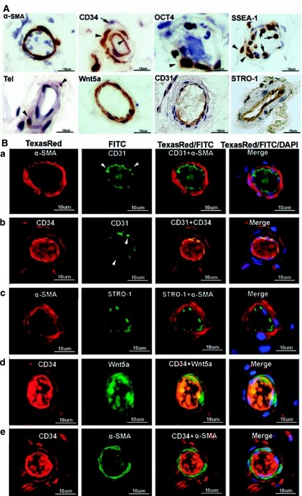 STRO-1 Antibody (39-8401)