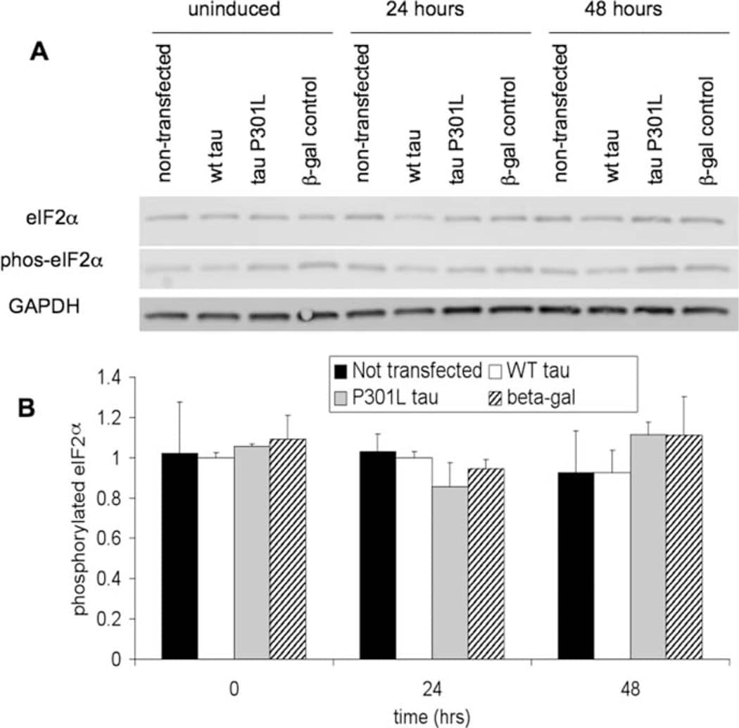 GAPDH Antibody (Monoclonal, ZG003)