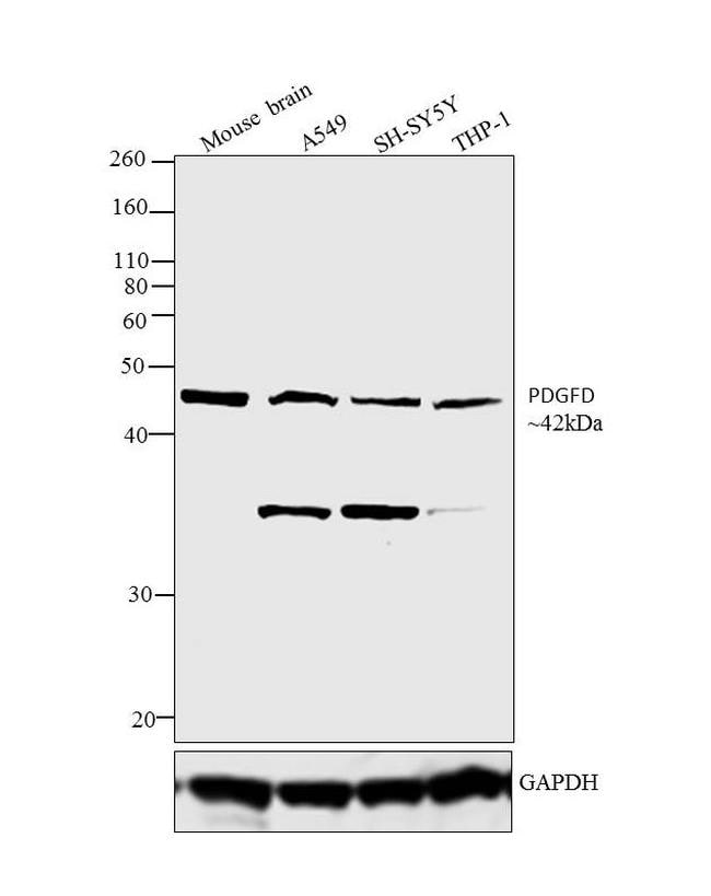 PDGF-D Antibody (40-2100)