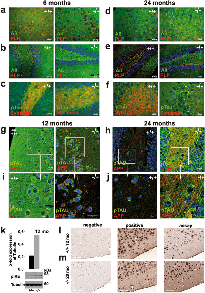 Phospho-Tau (Ser202, Thr205) Antibody (MN1020)