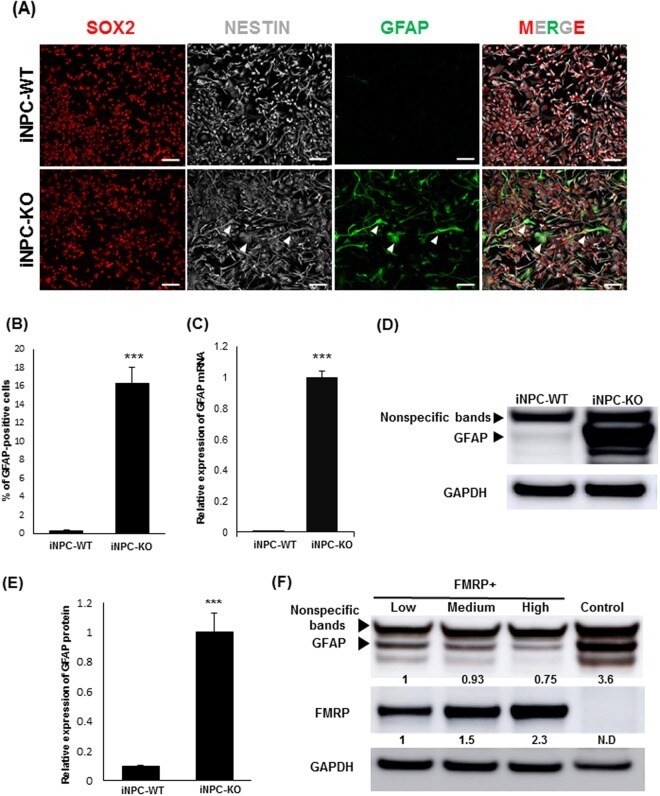 GFAP Antibody (13-0300)