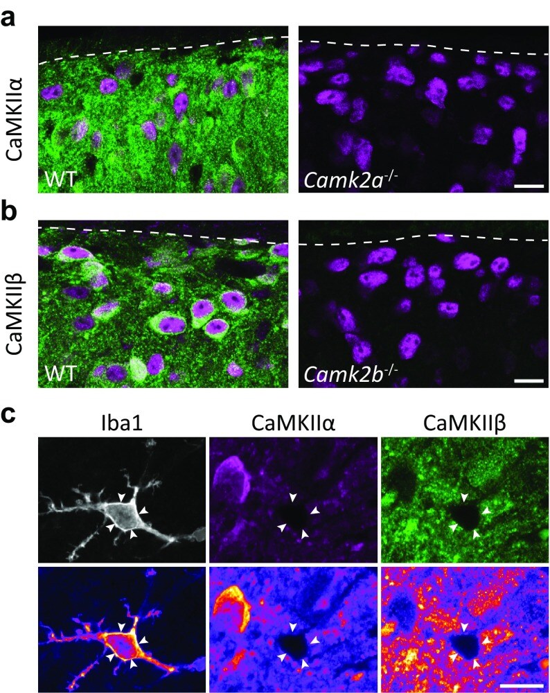 CaMKII alpha Antibody (MA1-048)