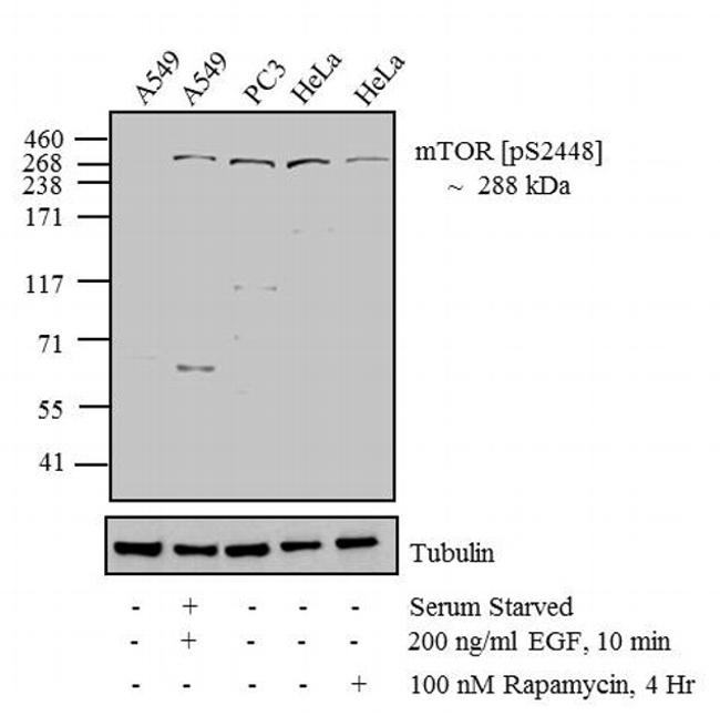 Phospho-mTOR (Ser2448) Antibody (44-1125G)