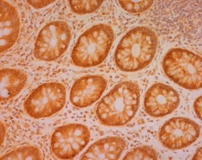 SDHB Antibody (459230)