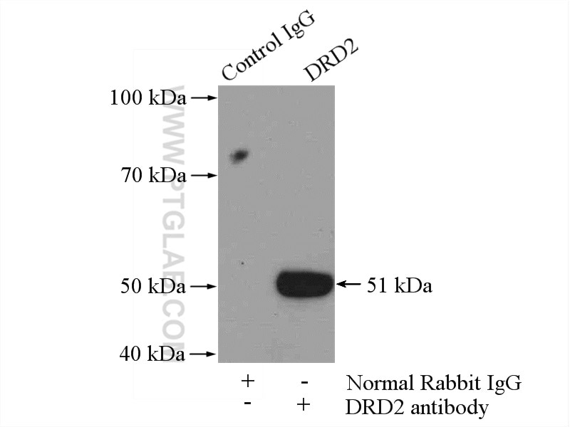 DRD2 Antibody (55084-1-AP)