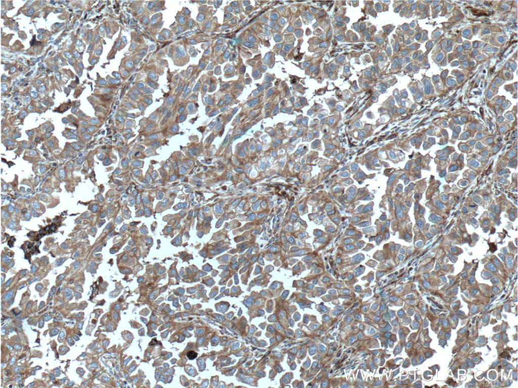 pan Ras Antibody (60309-1-IG)