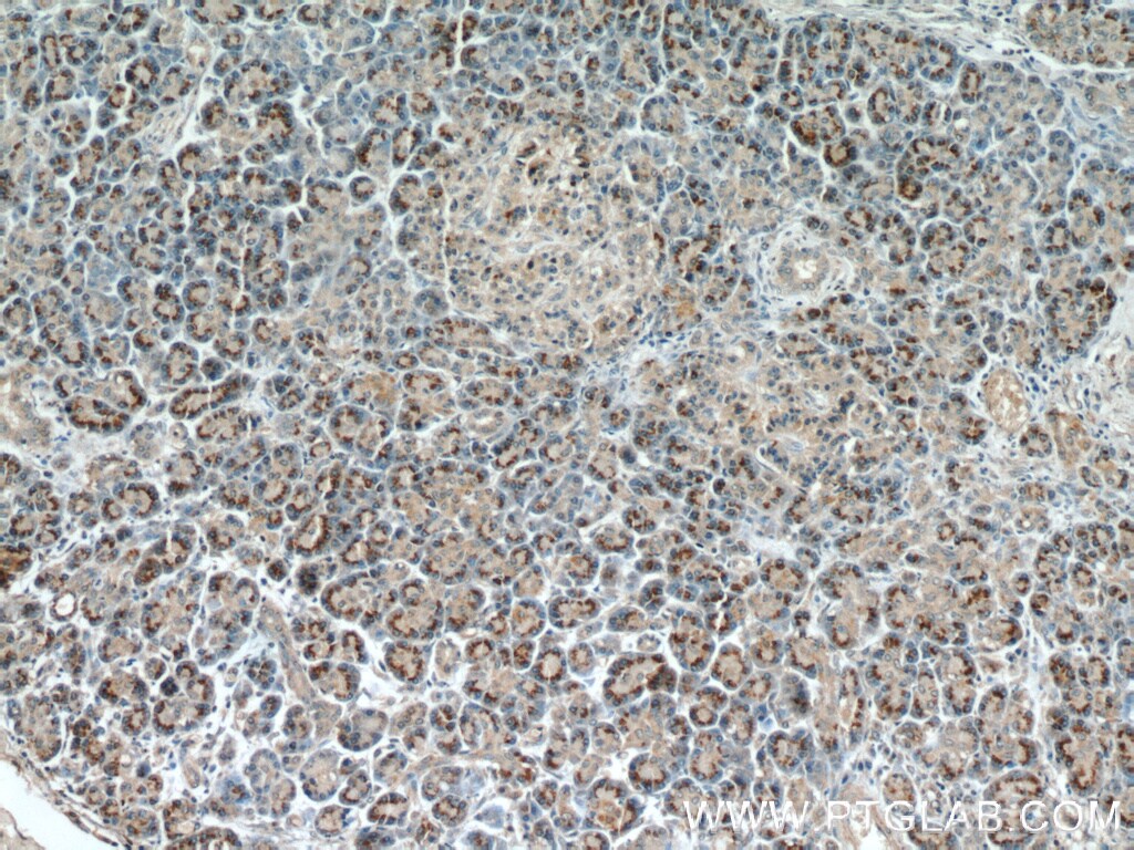 RPS3 Antibody (66046-1-IG)
