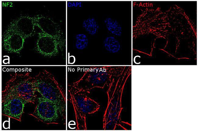 NF2 Antibody (702466)