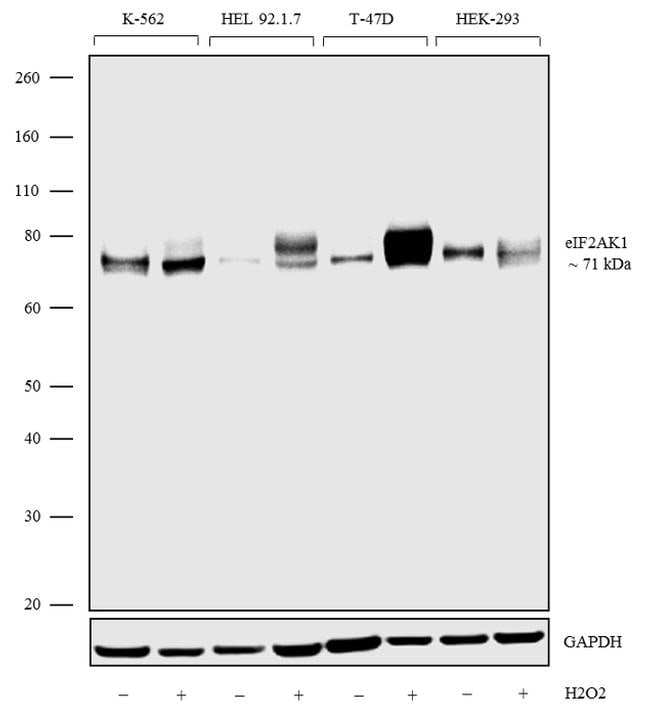 HRI Antibody (702551)