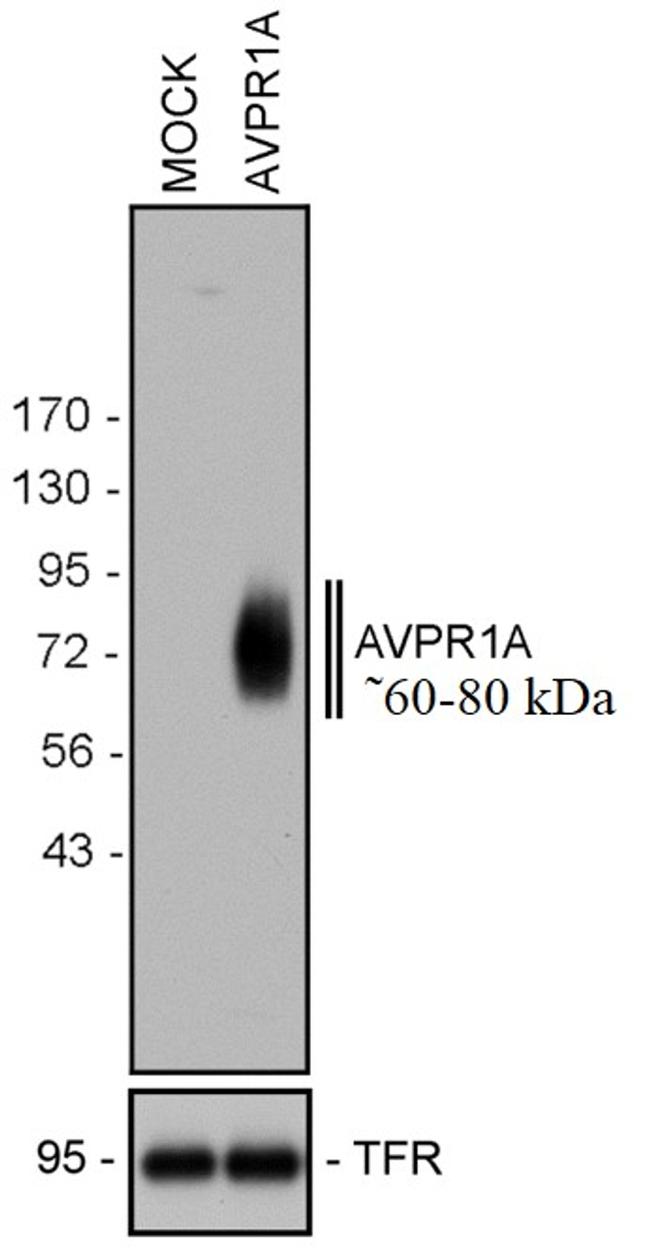 AVPR1A Antibody (702609)