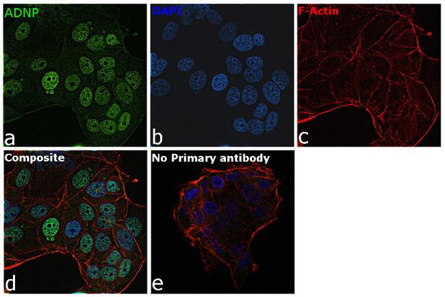 ADNP Antibody (702911)