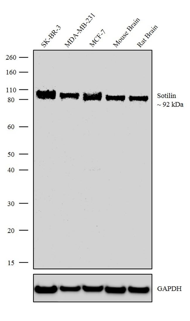 Sortilin Antibody (703207)