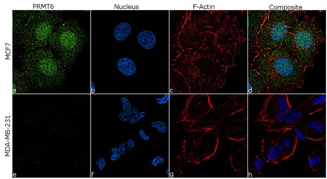 PRMT6 Antibody (703547)
