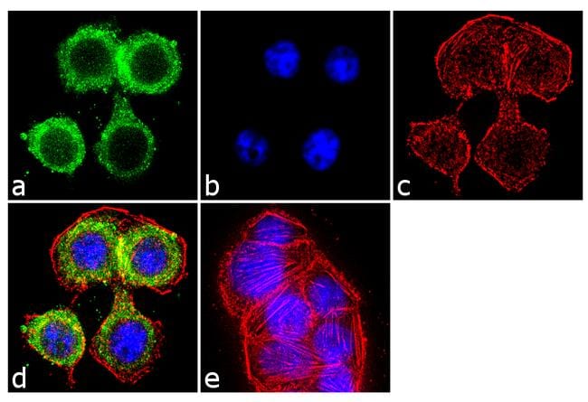 Anti-TGFBR2 Antibodies | Invitrogen