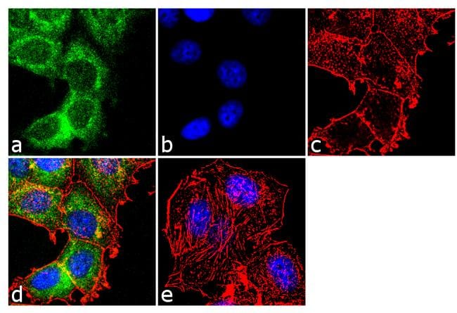 PRMT1 Antibody (720140)