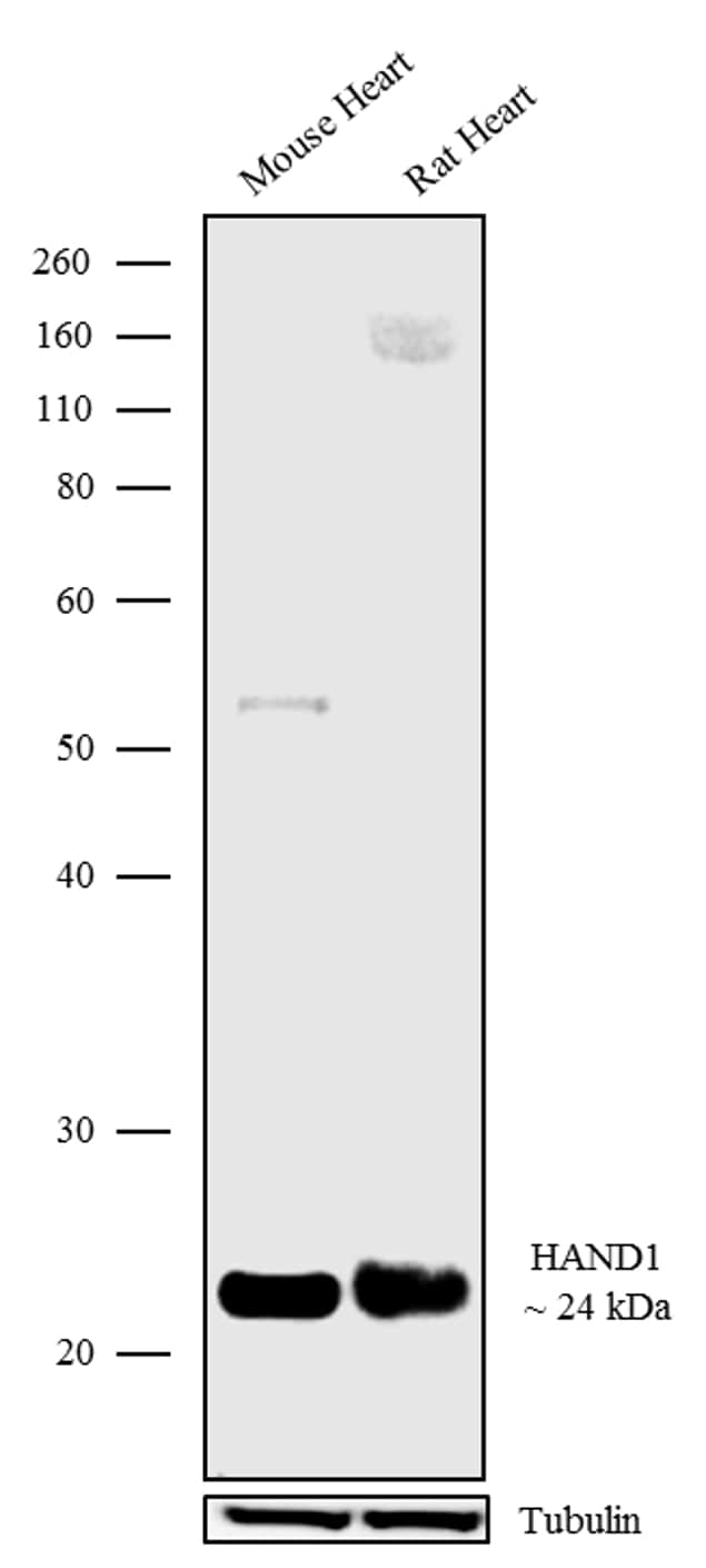 HAND1 Antibody (720261)