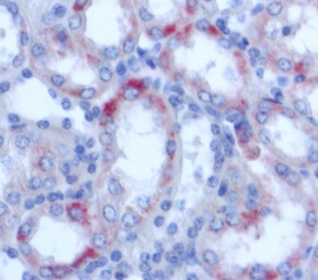 NGAL Antibody (ABS 048-28-02)