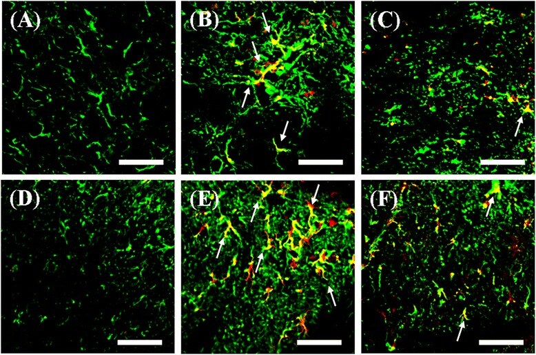 TNF alpha Antibody (ARC3012)