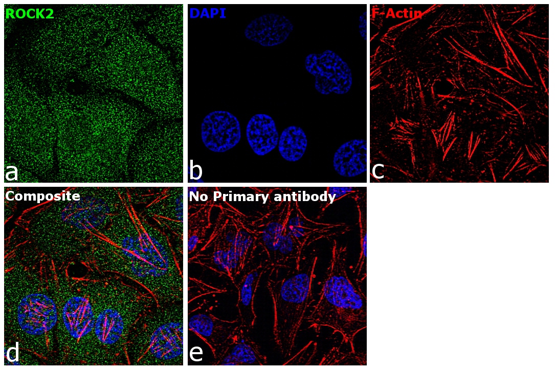 ROCK2 Antibody (LF-PA0049)