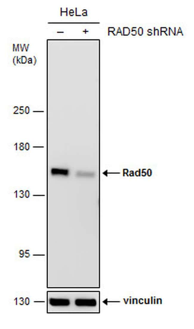 RAD50 Antibody (MA1-23269)