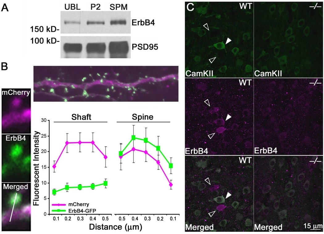 CaMKII alpha Antibody (MA1-048)