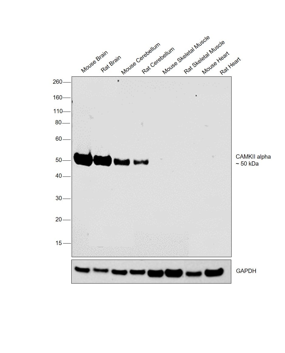 CaMKII alpha Antibody (MA1-048)