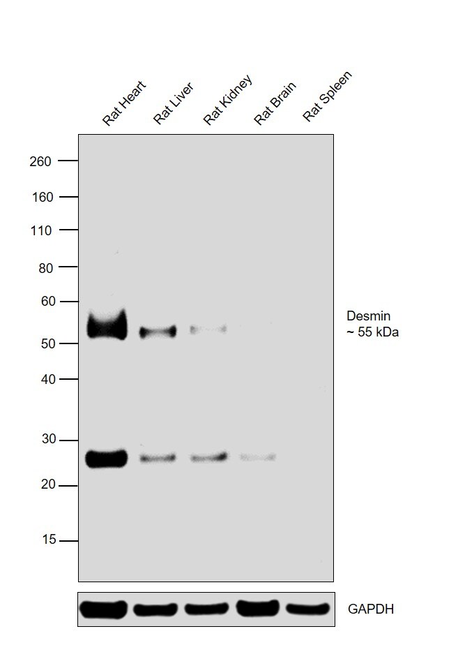 Desmin Antibody (MA1-06401)