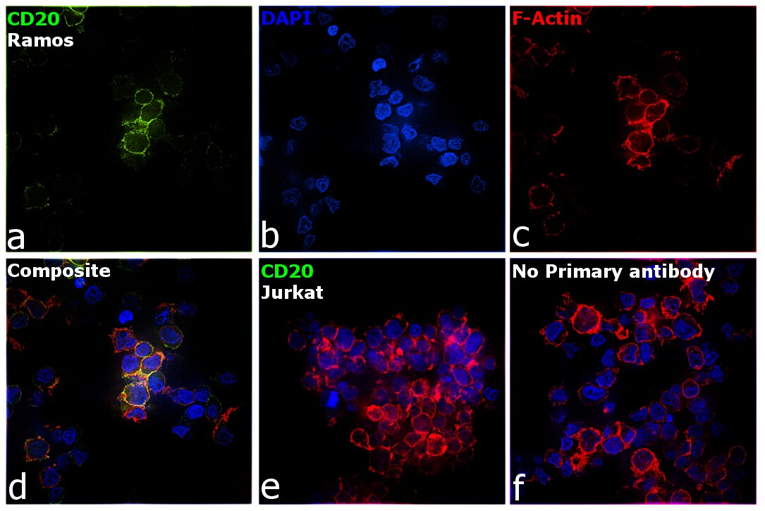 CD20 Antibody (MA1-10135)