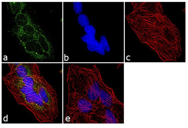 rRNA Antibody (MA1-13017)