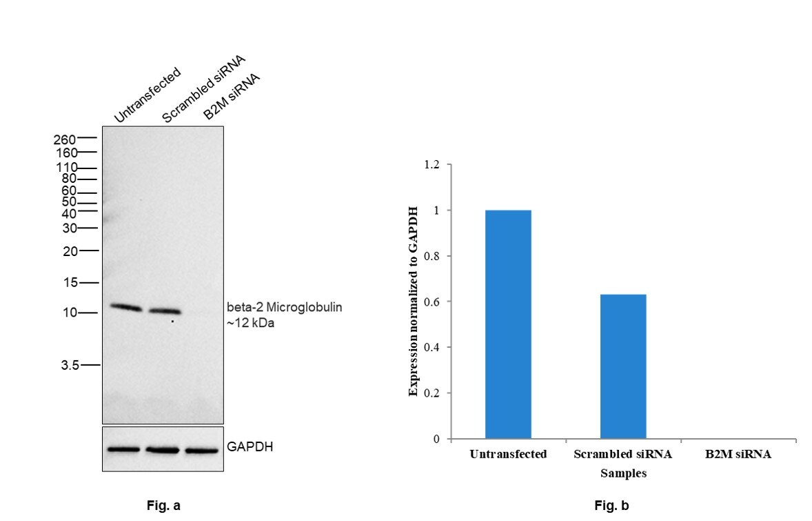 beta-2 Microglobulin Antibody (MA1-19141)