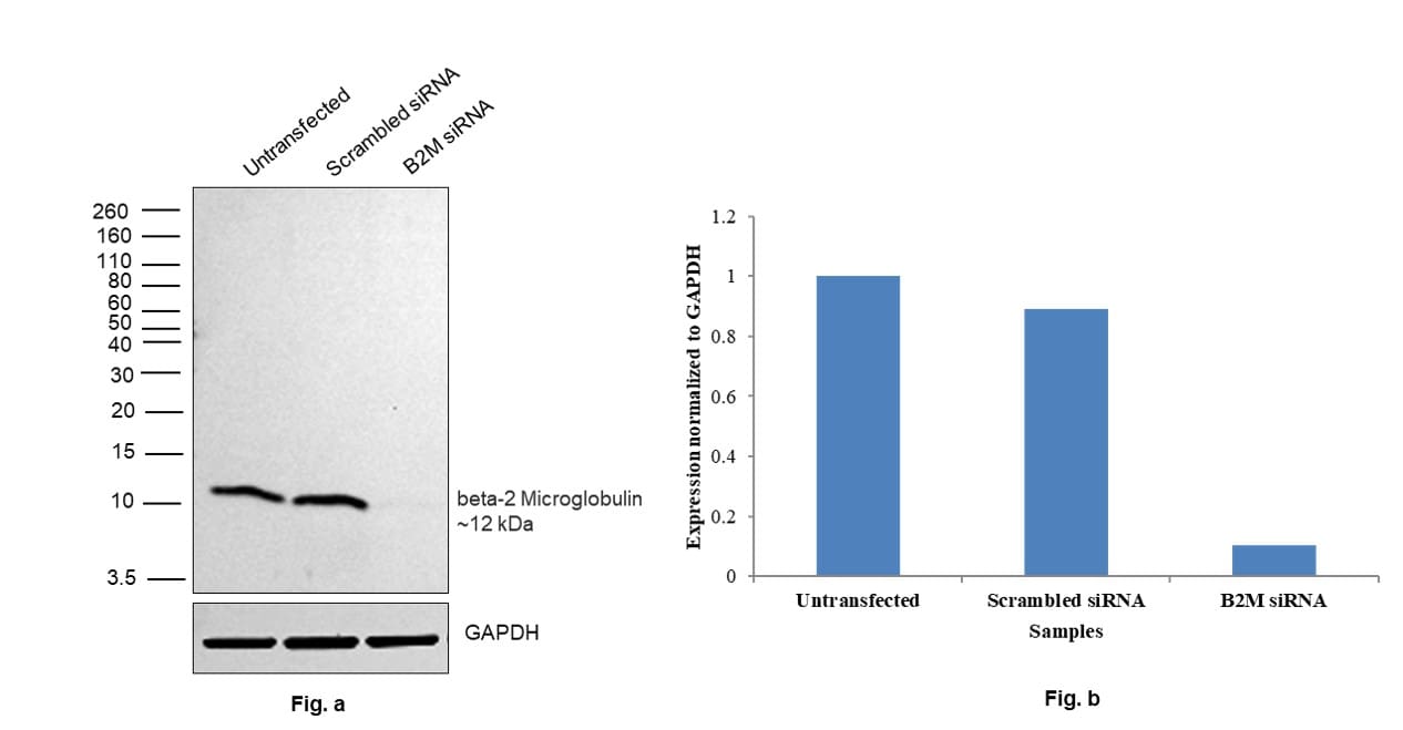 beta-2 Microglobulin Antibody (MA1-19413)