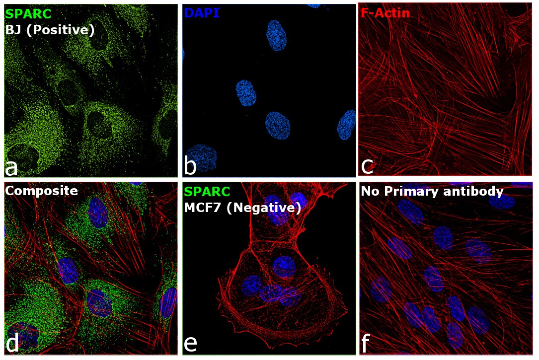 SPARC Antibody (MA1-21420)