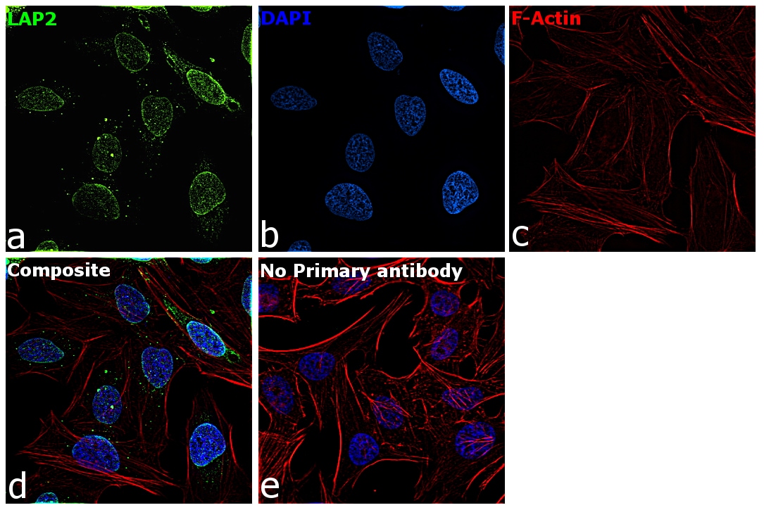 LAP2 Antibody (MA1-25323)