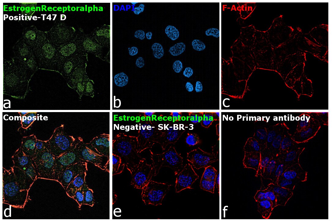 Estrogen Receptor alpha Antibody (MA1-27107)