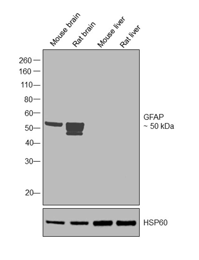 GFAP Antibody (MA1-35376)