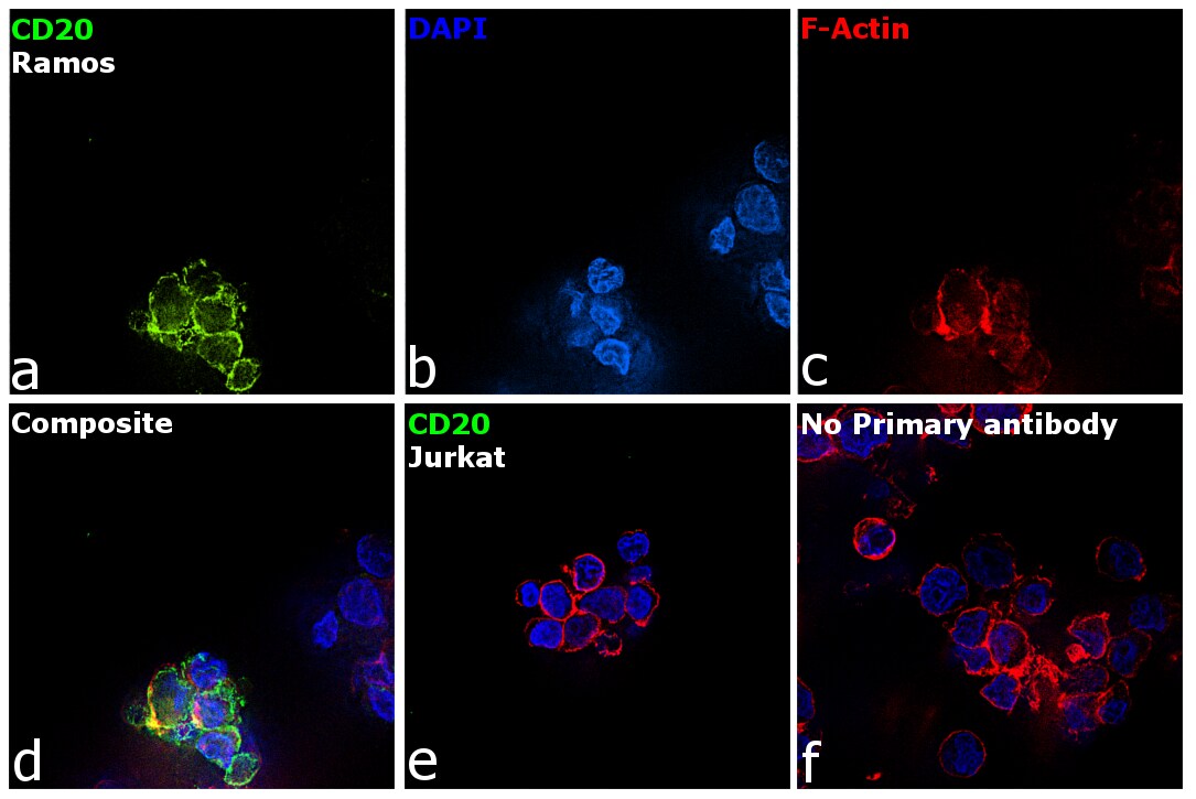 CD20 Antibody (MA5-16334)