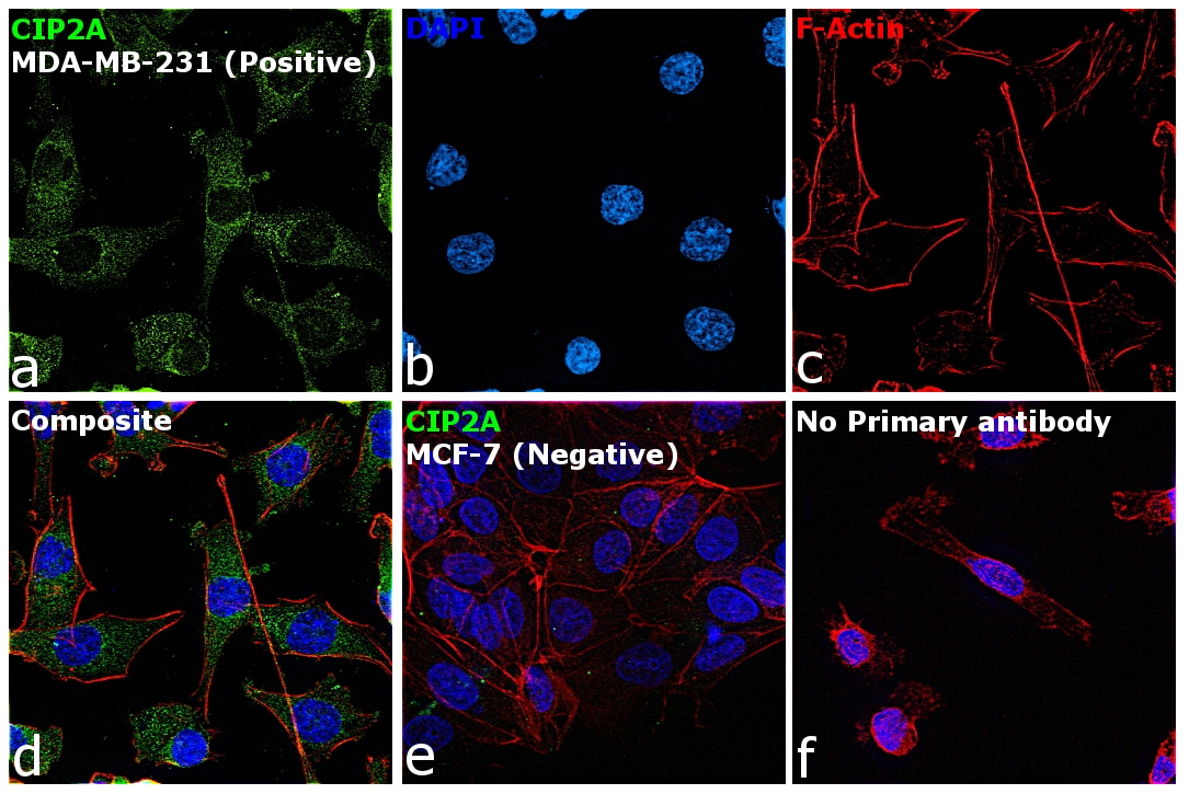 CIP2A Antibody (MA1-46001)