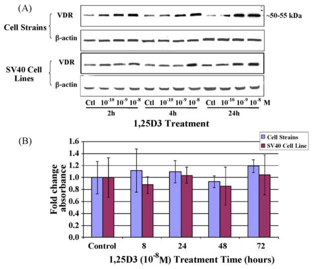 VDR Antibody (Monoclonal, 9A7)