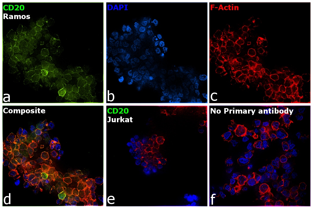 CD20 Antibody (MA1-82400)