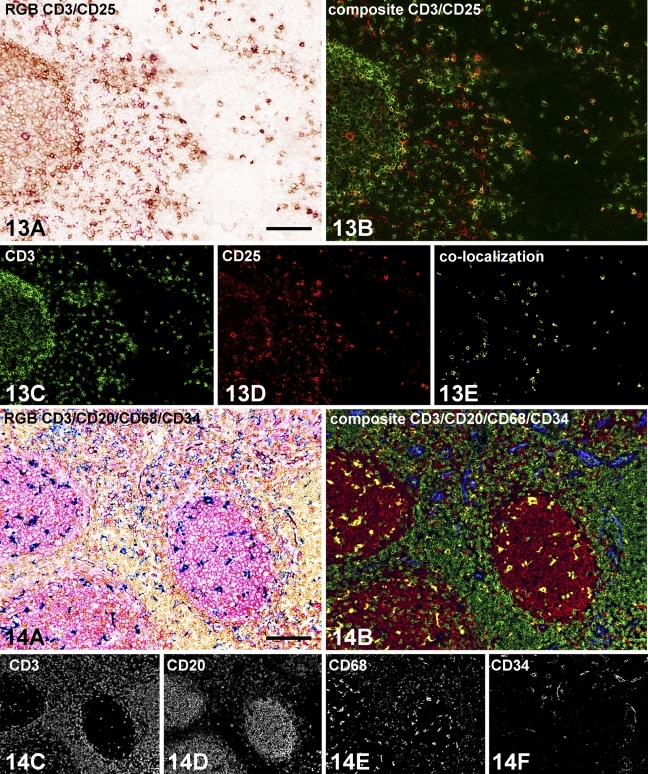 CD3e Antibody (Monoclonal, SP7)