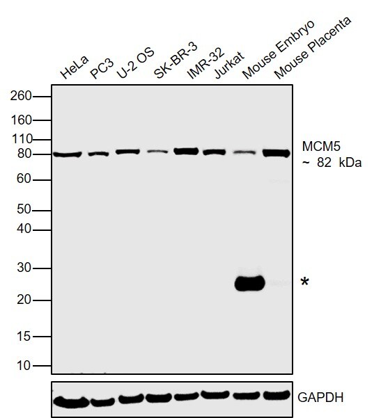 MCM5 Antibody (MA1-91112)