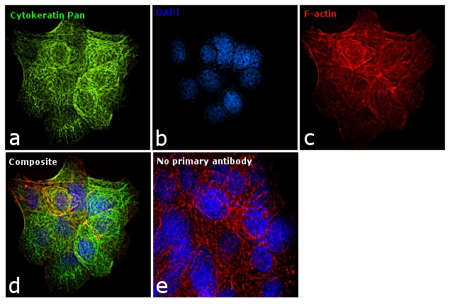 Cytokeratin Pan Antibody (MA1-91326)