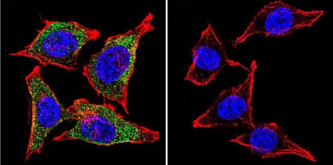 Vimentin Antibody (MA3-745)