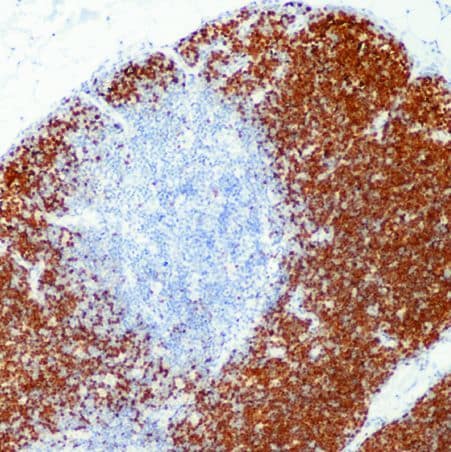 TdT Antibody (MA5-11466)