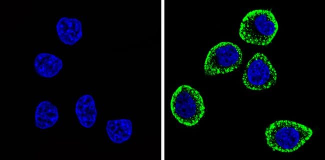 CD56 Antibody (MA5-11563)