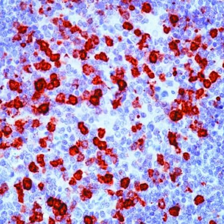 CD57 Antibody (MA5-11605)