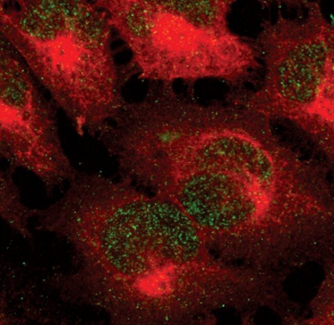 Phospho-STAT5 alpha (Tyr694) Antibody (MA5-14822)